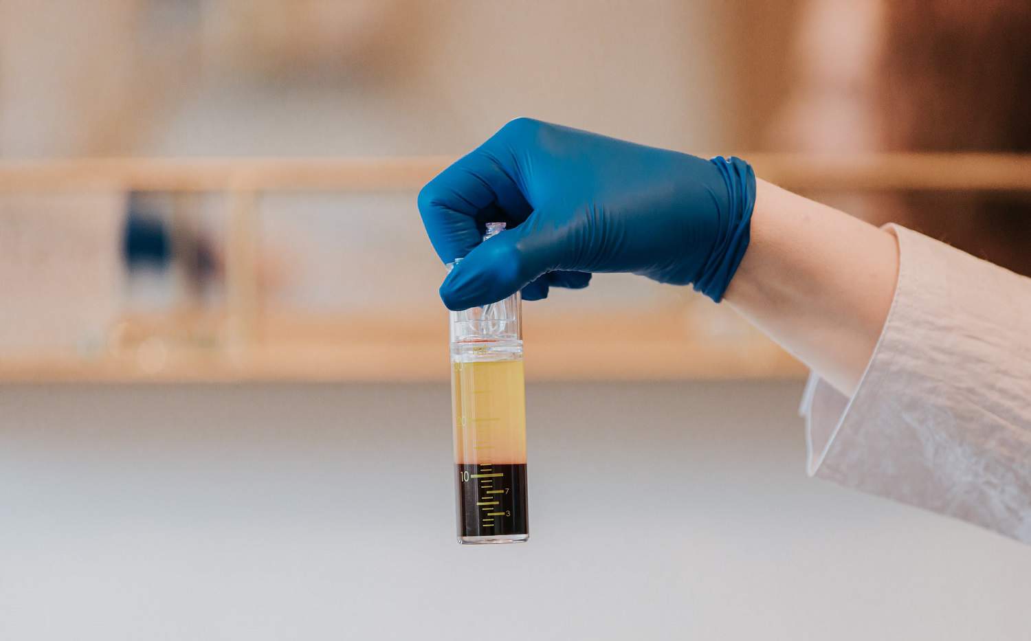 Hair Restoration, PRP & Skin Rejuvenation | Tacoma, WA , USA